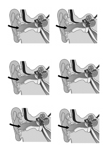 Ears and Hearing SP4e Edexcel 9-1 GCSE Physics Waves | Teaching Resources
