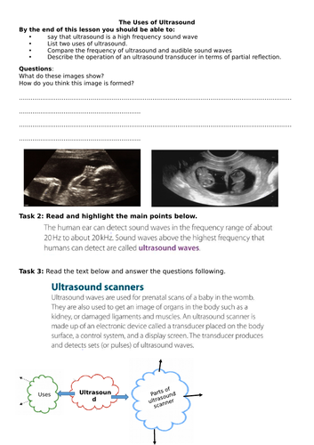 P12.6 Uses of Ultra sound | Teaching Resources