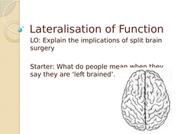 Lateralisation of the Brain | Teaching Resources