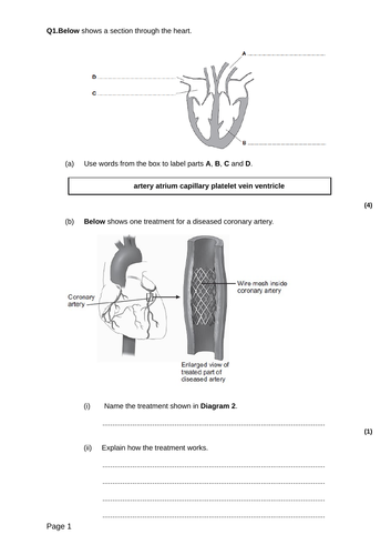 GCSE Biology - Problems with the Heart - Internet research lesson and ...