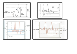 Mechanics of breathing with spirometry traces supported with examples ...