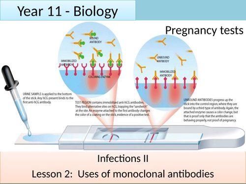 AQA SoW 9-1 triple biology infections | Teaching Resources