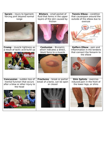Sports Science R041 Injury - Revision Pack | Teaching Resources