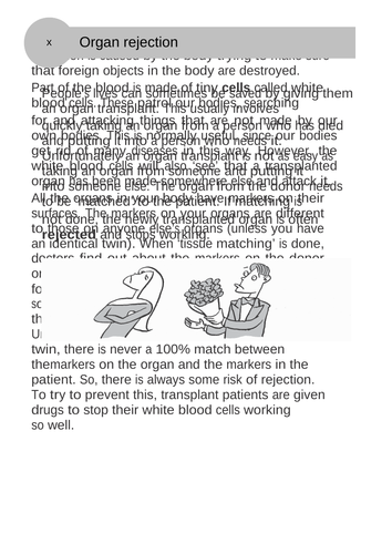 KS3 Unit 7A Biology- Organs (7A life 7B organs 7C microscope 7D plant ...