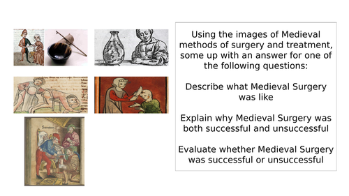 Medieval Surgery | Teaching Resources