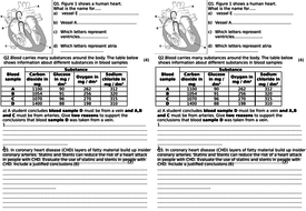 AQA Coronary Heart Disease and Interventions | Teaching Resources