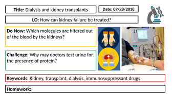 AQA GCSE Biology New Specification - B5 Dialysis and kidney transplants ...