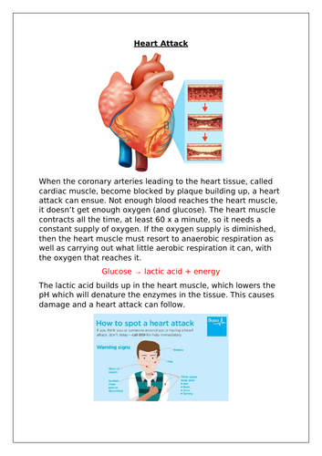 Heart attack | Teaching Resources