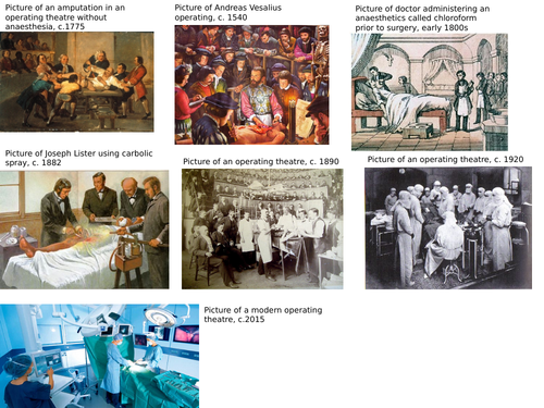 Britain Health and the People, c.1000 - Present Day (AQA) | Teaching ...