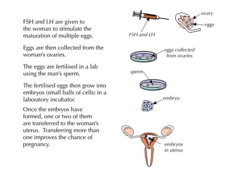 Topic 5 Contraception and fertility treatment AQA trilogy | Teaching ...