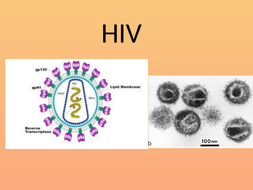 HIV | Teaching Resources