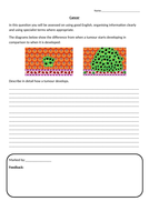 KS4 AQA Biology (Science) Cancer Lesson & Activities | Teaching Resources