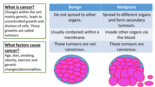 Cancer Activity - Biology GCSE | Teaching Resources