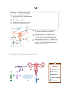 In Vitro Fertilization IVF | Teaching Resources