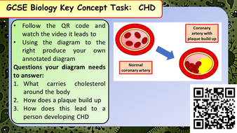 KS4 AQA GCSE Biology (Science) Coronary Heart Disease (CHD) Lesson ...
