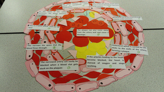 KS4 AQA GCSE Biology (Science) Coronary Heart Disease (CHD) Lesson ...