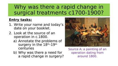 GCSE Medicine | 1800's Surgery | Teaching Resources