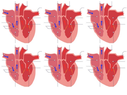 KS4 AQA GCSE Biology (Science) The Heart Lesson & Activities | Teaching ...