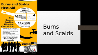 *FIRST AID* Burns and Scalds | Teaching Resources
