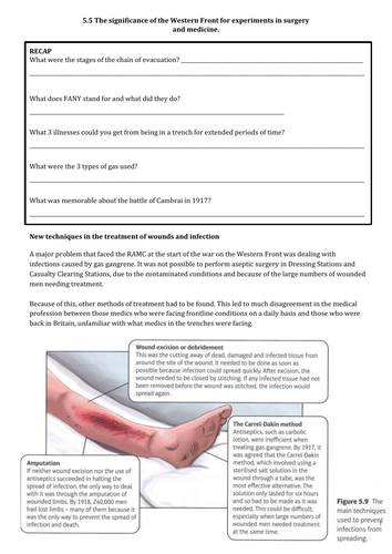 New techniques in treatment, Thomas Splint, Blood Transfusions, X-Ray ...