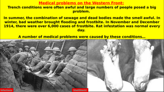 World War One: Injuries and Treatment | Teaching Resources