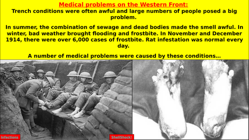 World War One - Complete Unit | Teaching Resources