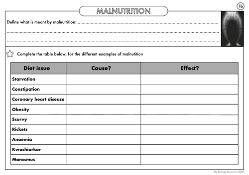 GCSE Biology: Complete Worksheet Pack on the Human Nutrition Topic ...