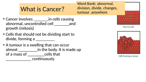 Cancer (GCSE) | Teaching Resources