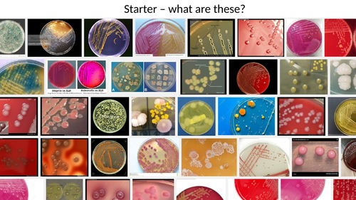 Culturing Micro-organisms KS4 entire lesson Biology GCSE | Teaching ...
