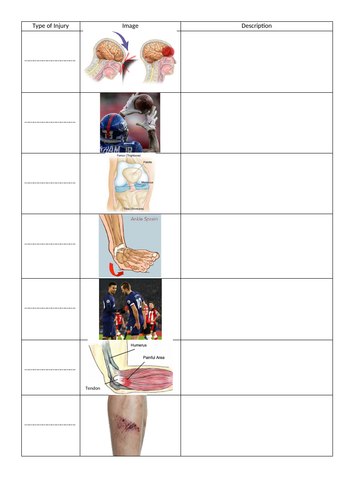 Injuries in Sport and Physical Activity - Edexcel GCSE PE (9-1 ...