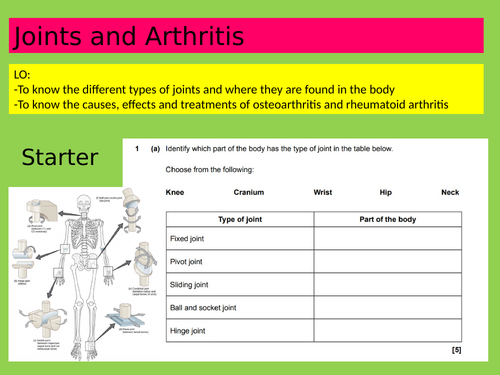 Anatomy and Physiology: Joints and Arthritis, Health and Social Care ...