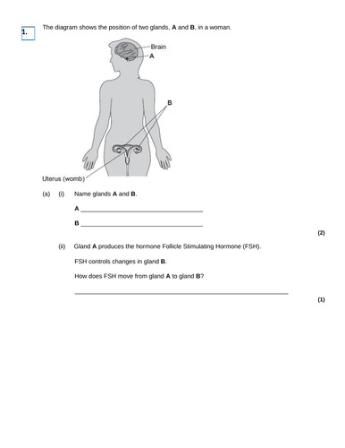 AQA GCSE Biology (9-1) B11.8 Infertility treatments FULL LESSON ...