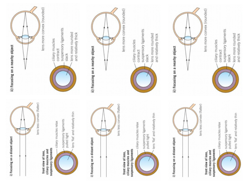 AQA GCSE Biology (9-1) B10.6 Common problems of the eye FULL LESSON ...