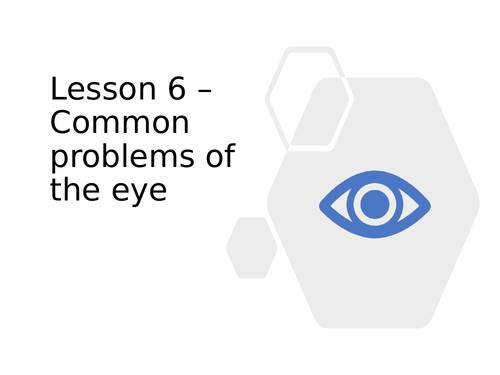 AQA GCSE Biology (9-1) B10.6 Common problems of the eye FULL LESSON ...