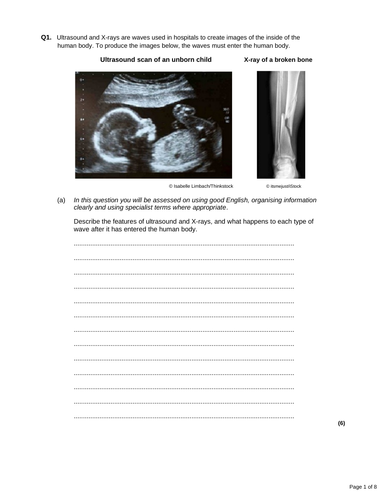 AQA GCSE Physics (9-1) - P13.4 Ultraviolet waves, X-rays, and gamma ...