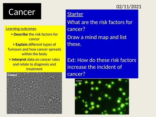 AQA GCSE Cancer | Teaching Resources