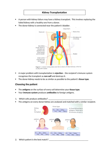AQA GCSE Science - Homeostasis - 'When Kidneys Go Wrong' | Teaching ...