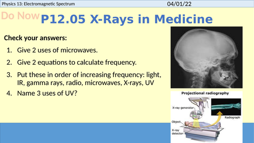 AQA GCSE Physics P13.05 X rays in medicine | Teaching Resources