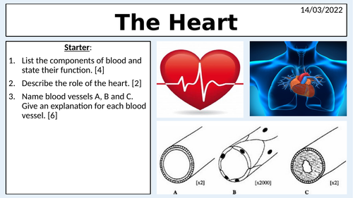 Blood, Blood Vessels, The Heart, Coronary Heart Disease & A Faulty ...
