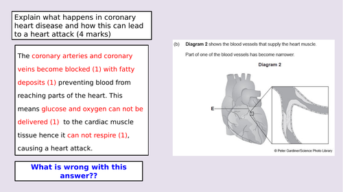 Blood, Blood vessels and the heart | Teaching Resources