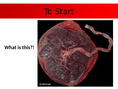 Placenta And Amniotic Sac Teaching Resources