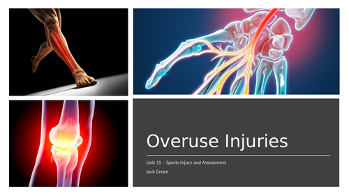 Unit 15 - Sports Injury and Assessment | Teaching Resources