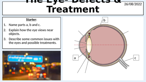 The Brain, The Eye & Control of Body Temperature (3 Triple Science ...