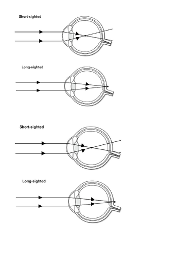 lesson_the eye_AQA GCSE | Teaching Resources