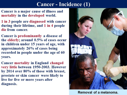 Bio2.13 Cancer - Introduction | Teaching Resources