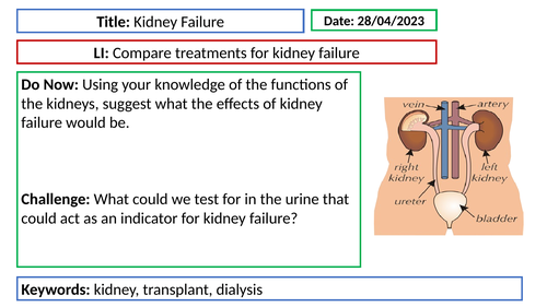 GCSE/iGCSE Biology: Dialysis and Kidney transplant | Teaching Resources