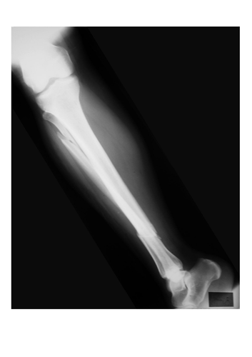 HOSPITAL ROLE PLAY RESOURCE KS1 EYFS | Teaching Resources