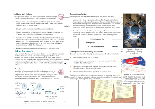 Homeostasis & Response - 4.5 (AQA GCSE 1-9 Biology: Complete Topic ...