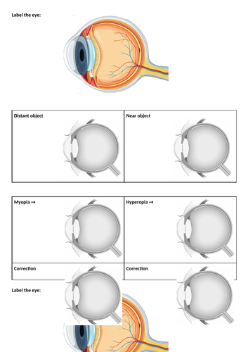 AQA GCSE Biology B5 The eyes + eye problems | Teaching Resources