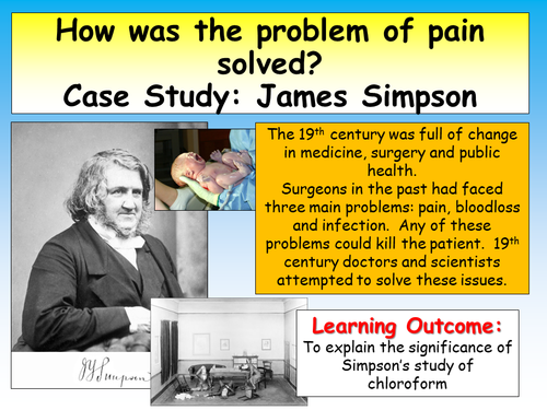 Simpson & Anaesthetics | Teaching Resources